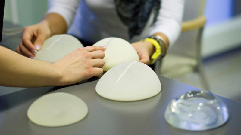 Retiran implantes de seno por riesgo de cáncer – Telemundo McAllen (40)