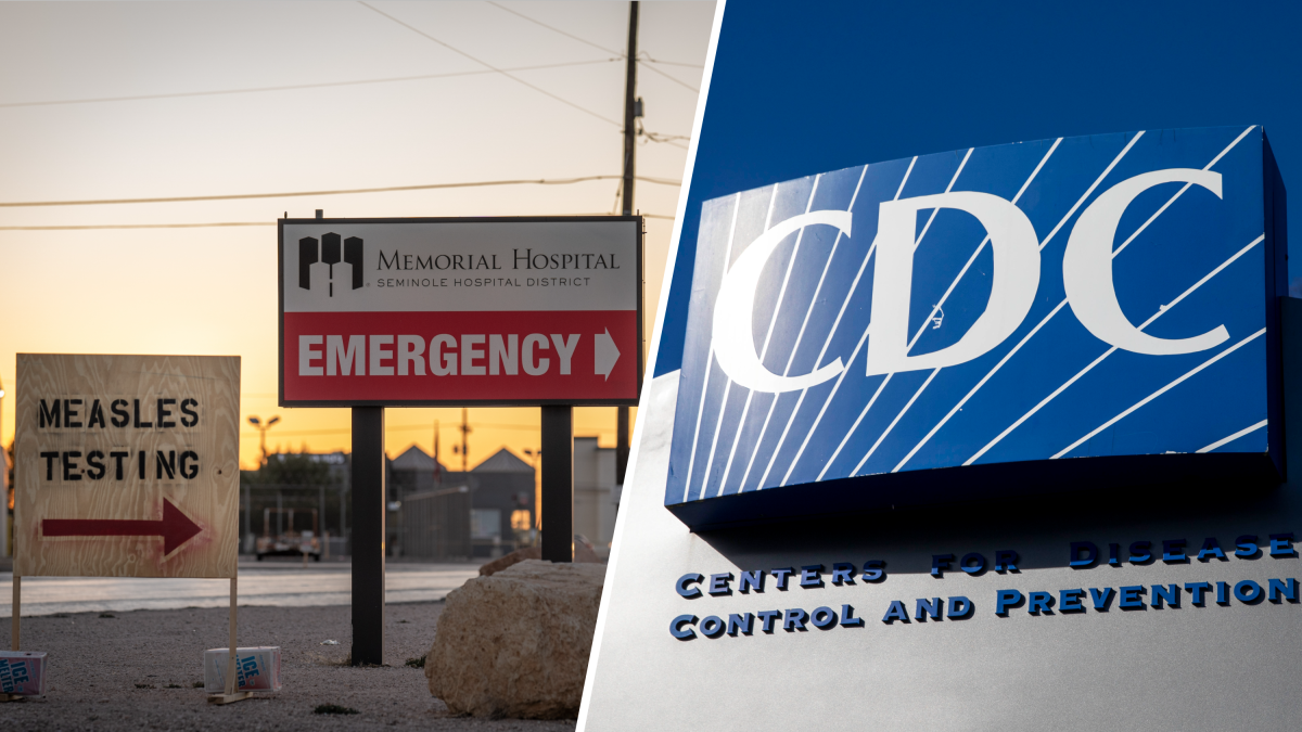 CDC dice que gran cantidad de casos de sarampión no se reportan ...